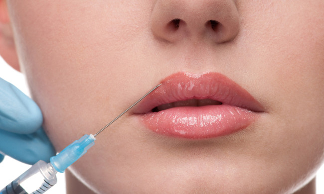 Preenchimento Labial – Tipos, Preço, Antes e Depois!