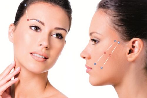 Fio Russo e Búlgaro: O que é? Preço e fotos antes e depois!